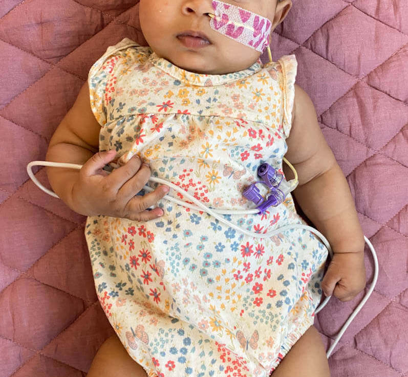 Feeding Tube Awareness Guide: What’s that thing in her nose?