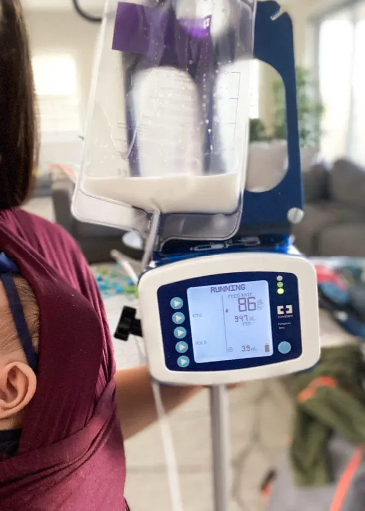 Lines and Tubes and Beeps, oh My!: A Baby After Open Heart Surgery