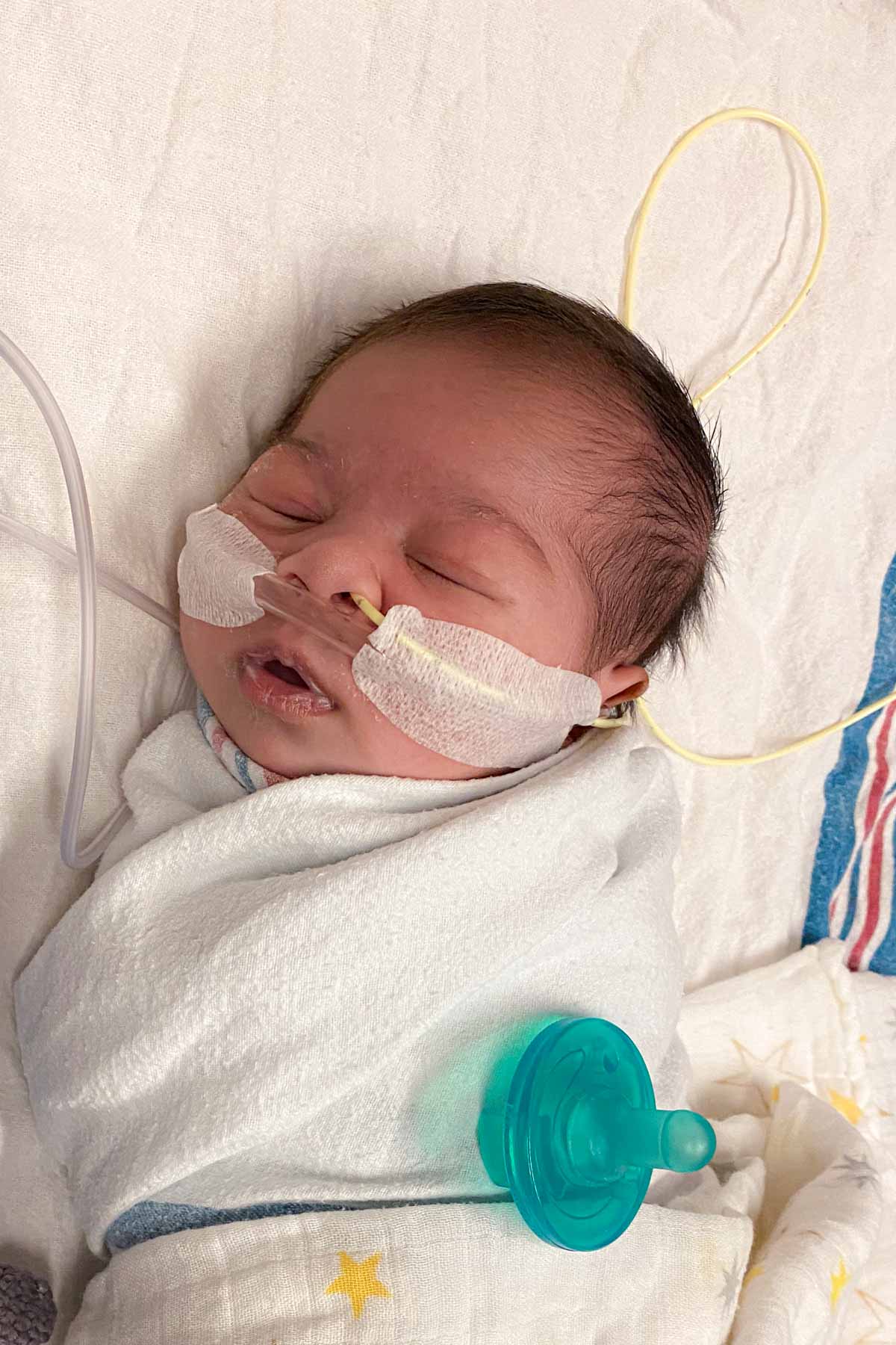 Lines and Tubes and Beeps, oh My!: A Baby After Open Heart Surgery