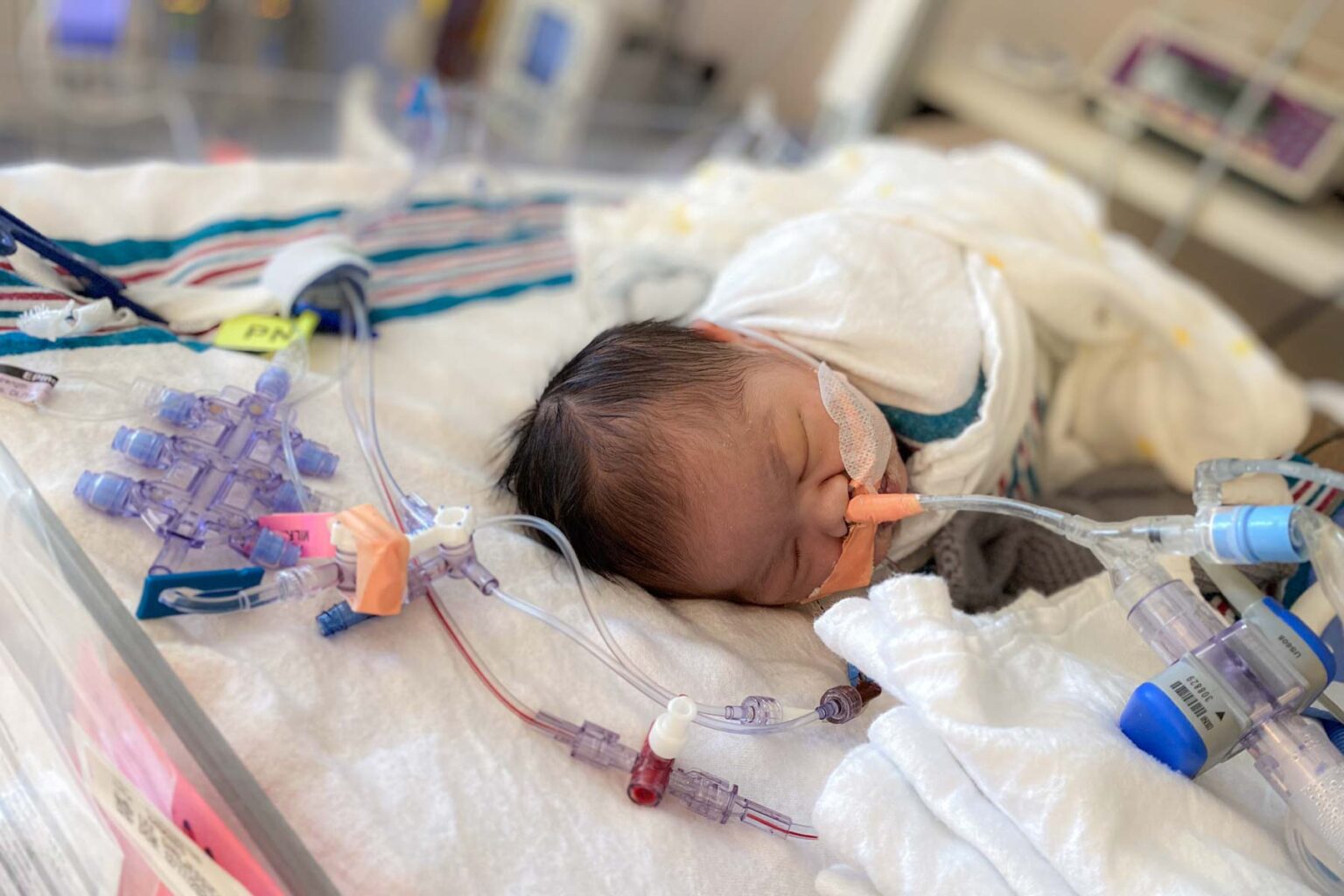 Lines and Tubes and Beeps, oh My!: A Baby After Open Heart Surgery