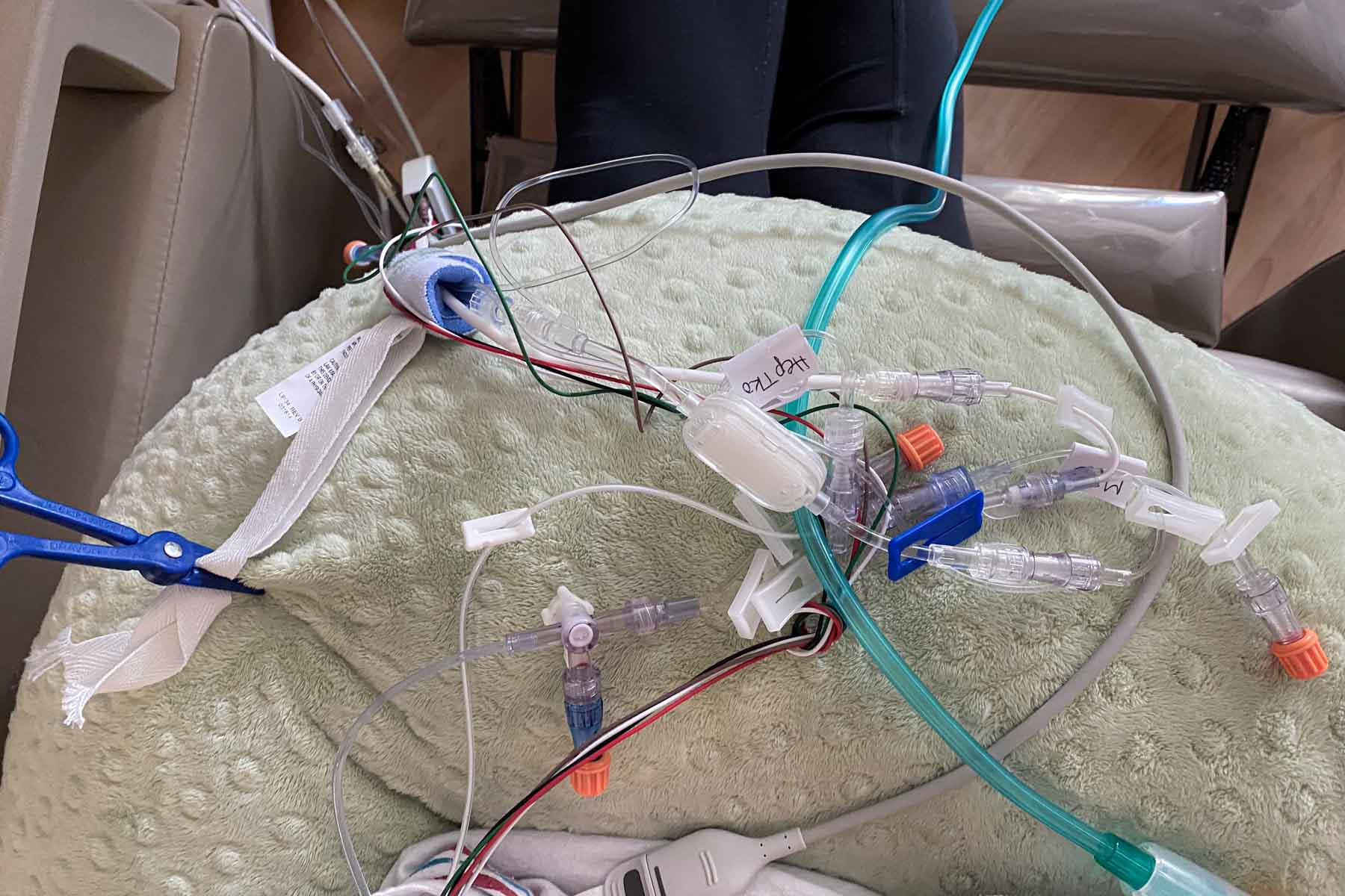 Lines and Tubes and Beeps, oh My!: A Baby After Open Heart Surgery